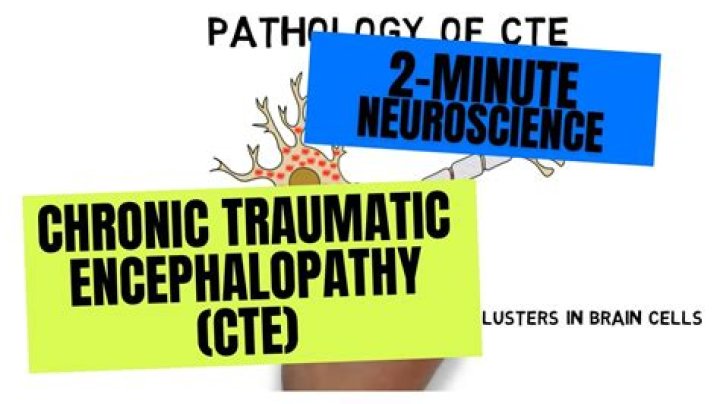 How long does CTE take to develop - The Daily Insight