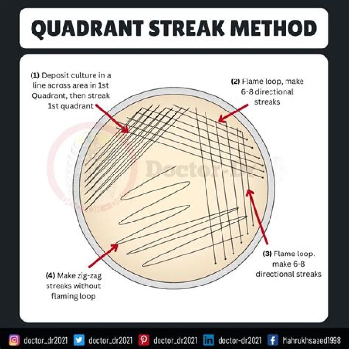 What does having a yellow streak mean - The Daily Insight