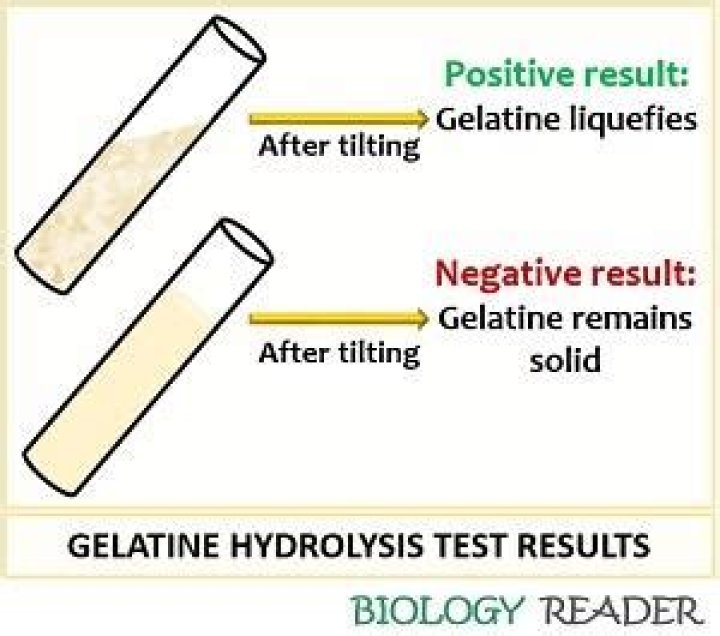 What does the gelatinase test for - The Daily Insight